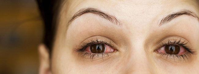 Los Efectos Secundarios Del THC - Zamnesia Blog